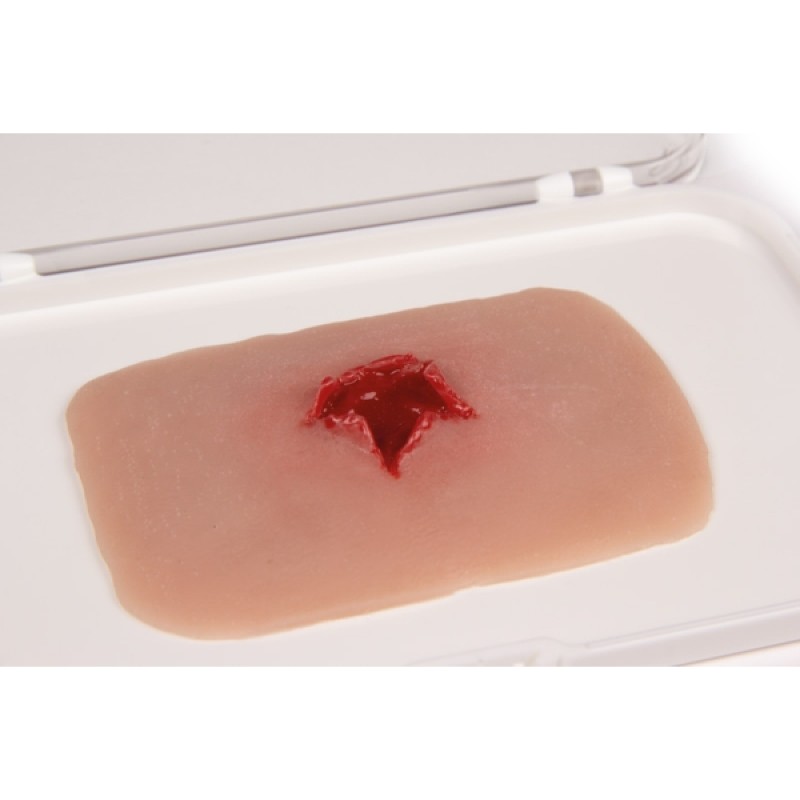 Erler Zimmer Wound Moulage Bullet Exit Hole | Health and Care